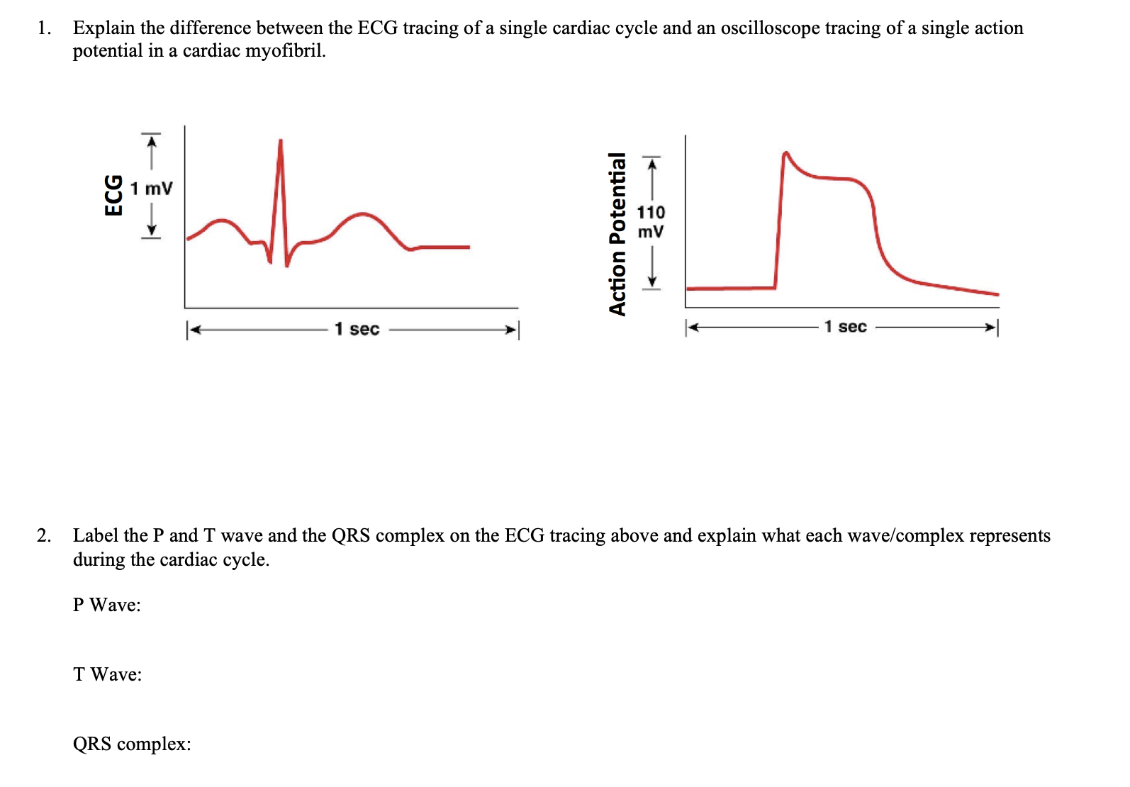 Solved 1. Explain the difference between the ECG tracing of | Chegg.com