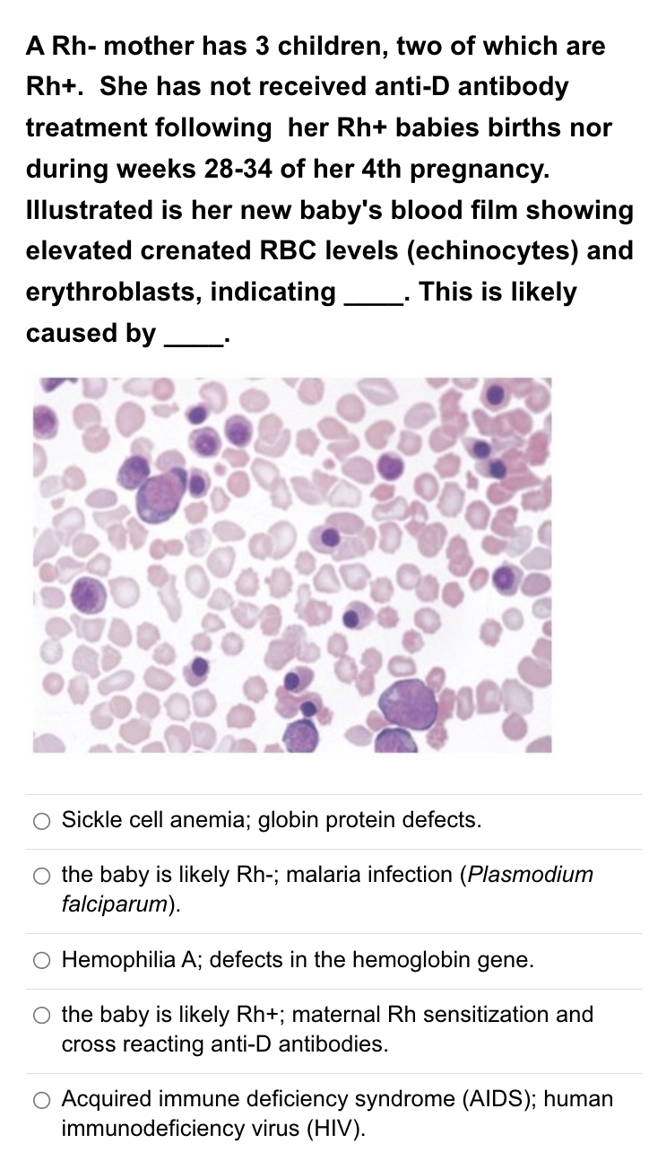 Solved A Rh- mother has 3 children, two of which are Rh+. | Chegg.com