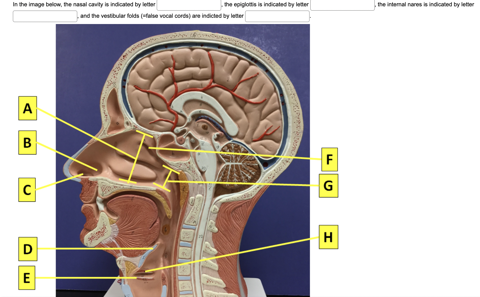 Solved In the image below, the nasal cavity is indicated by | Chegg.com
