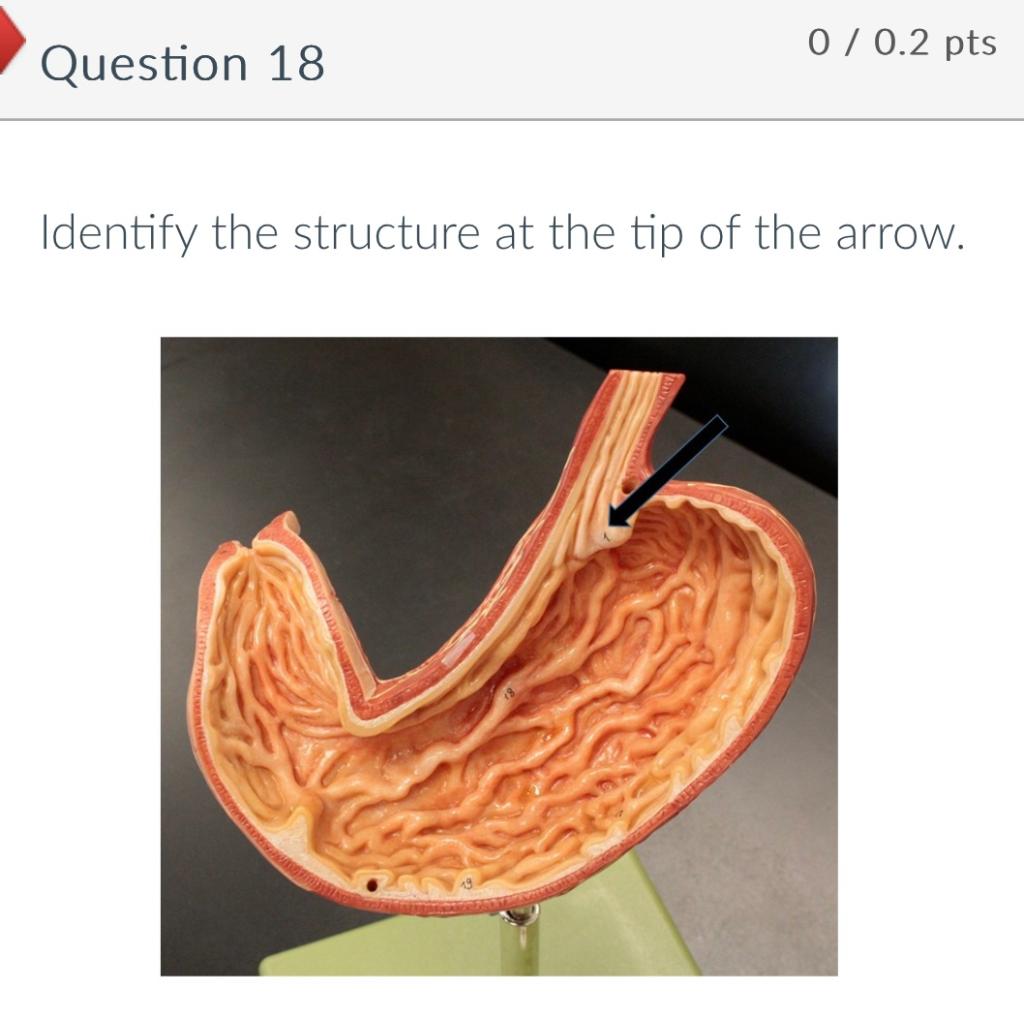 Solved Identify the structure at the tip of the | Chegg.com