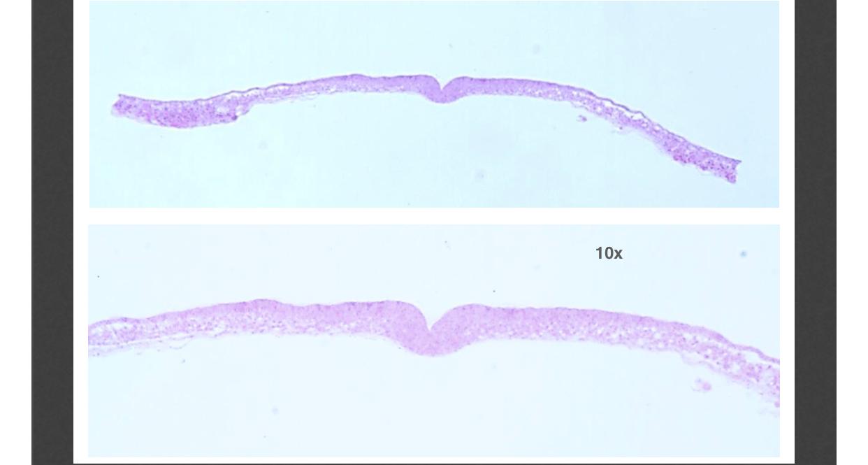 Solved find the c.s. that is part of the proamnion and see | Chegg.com