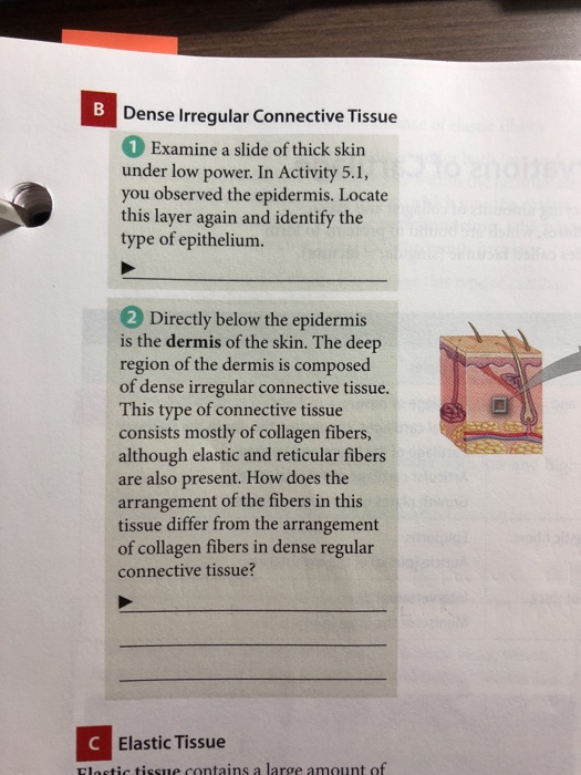 Solved Dense Irregular Connective Tissue 1 Examine a slide | Chegg.com