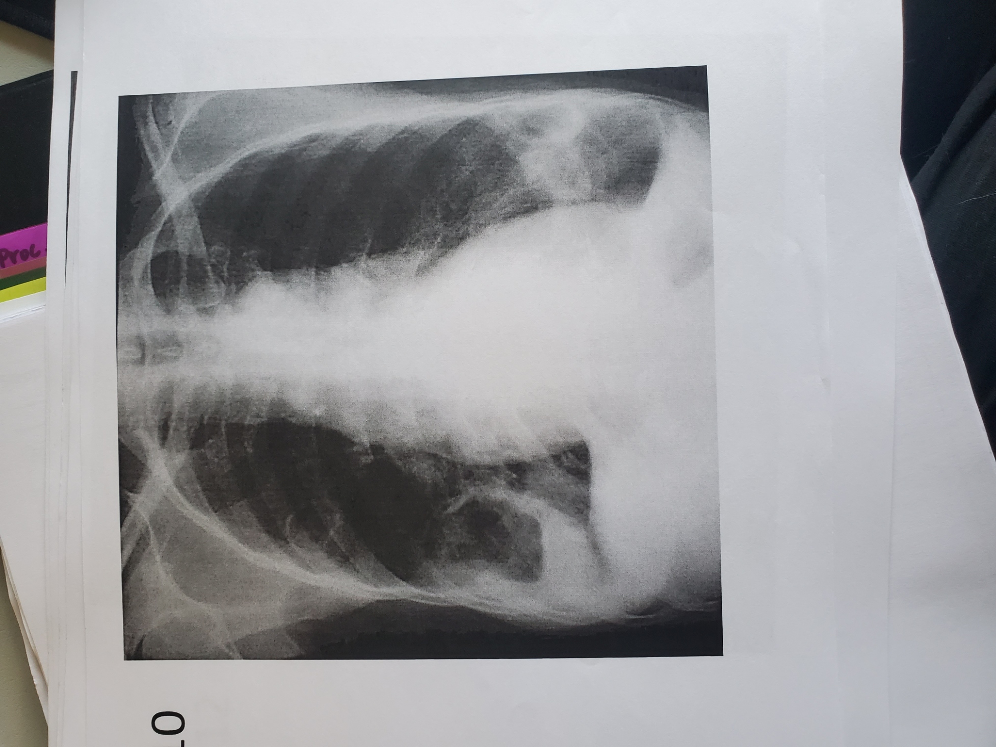 10- interpret this CXR and explain reasoning behind | Chegg.com