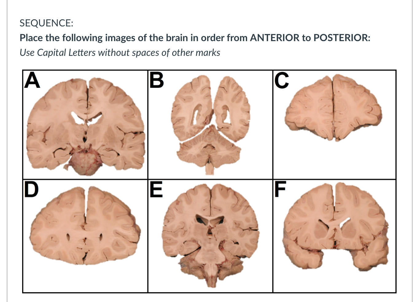 Posterior Anterior Brain