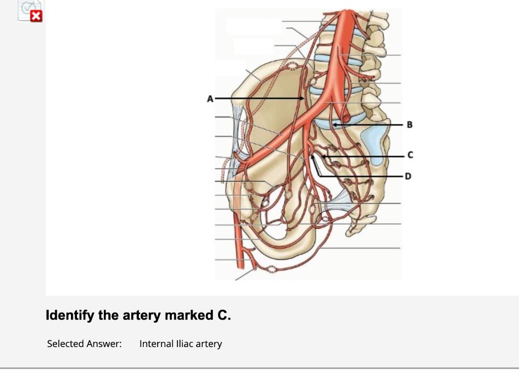 Solved Identify the artery marked AA. Selected Answer: | Chegg.com