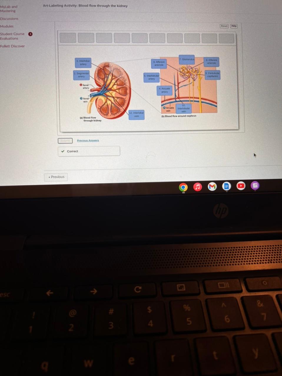 Solved Art-Labeling Activity: Blood flow through the kidney | Chegg.com