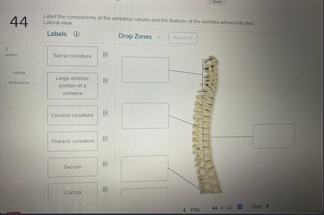Solved 44Label the components of the vertebral column and | Chegg.com