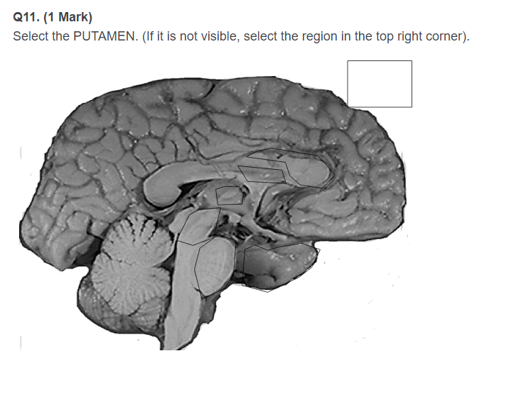 Solved Select the PUTAMEN. (If it is not visible, select the | Chegg.com