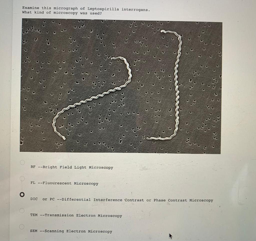 Solved Examine this micrograph of an Escherichia coli | Chegg.com