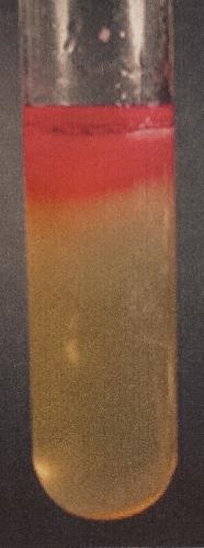 Solved The results of a sucrose fermentation test are shown | Chegg.com