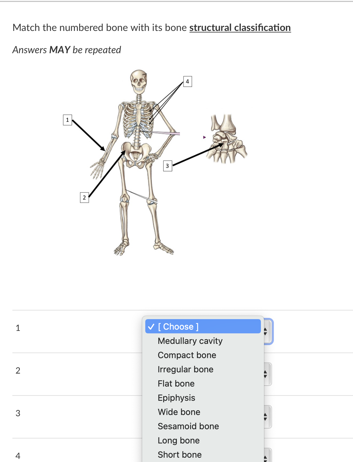 Solved Match the numbered bone with its bone structural | Chegg.com