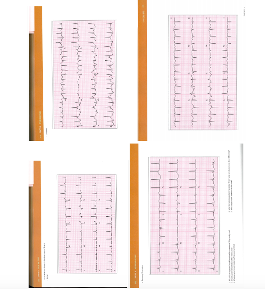 kNH 382 Assignment.CS.GXT-ECG-Echo (GXT with Imaging | Chegg.com