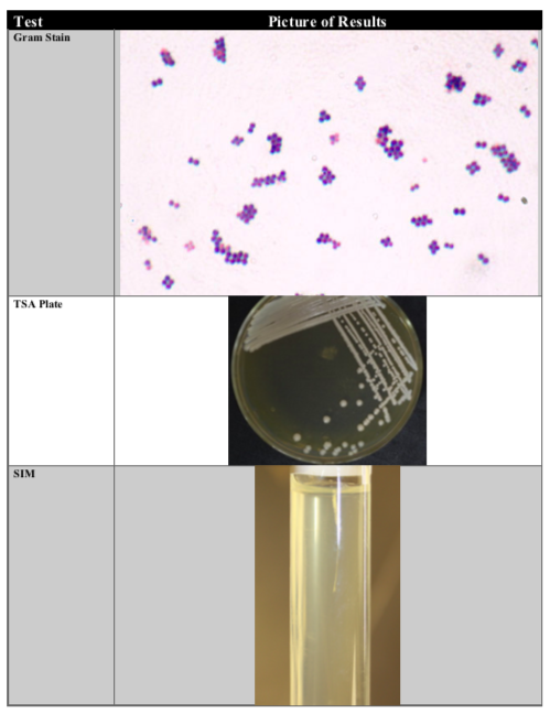 Solved Test Gram Stain Picture of Results TSA Plate SIM | Chegg.com