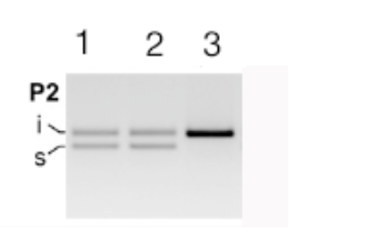 Solved b) The pre-mRNA coding for P2 is alternatively | Chegg.com