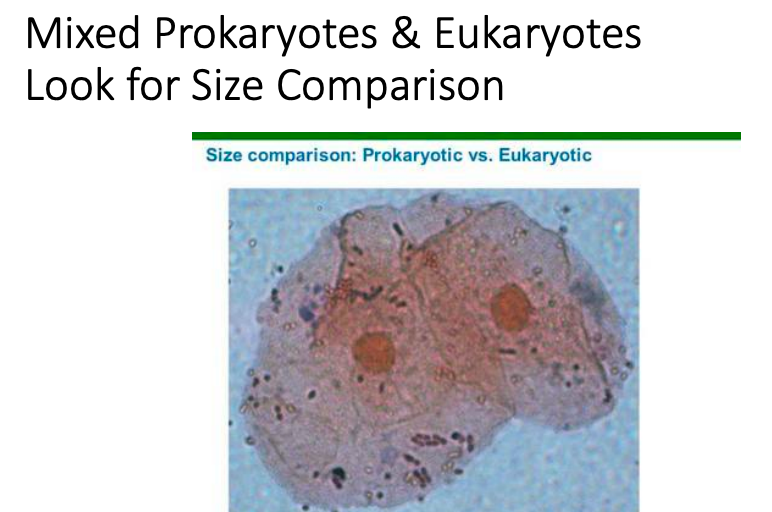 Solved Observe the Mixed Prokaryotes and Eukaryotes slide. | Chegg.com