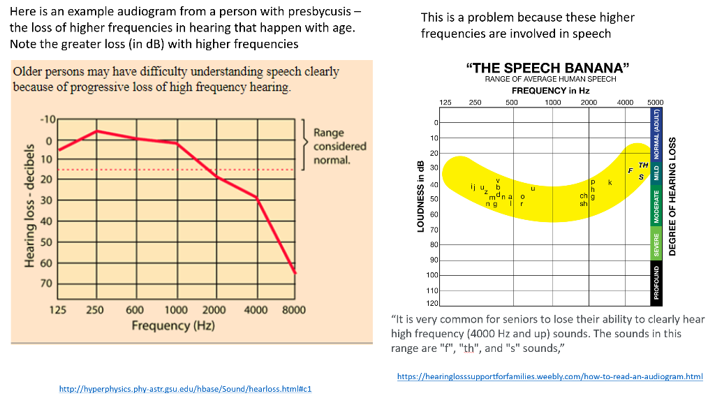 Solved Here is an example audiogram from a person with | Chegg.com