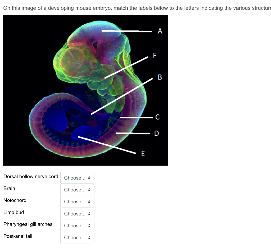 Solved On this image of a developing mouse embryo, match the | Chegg.com