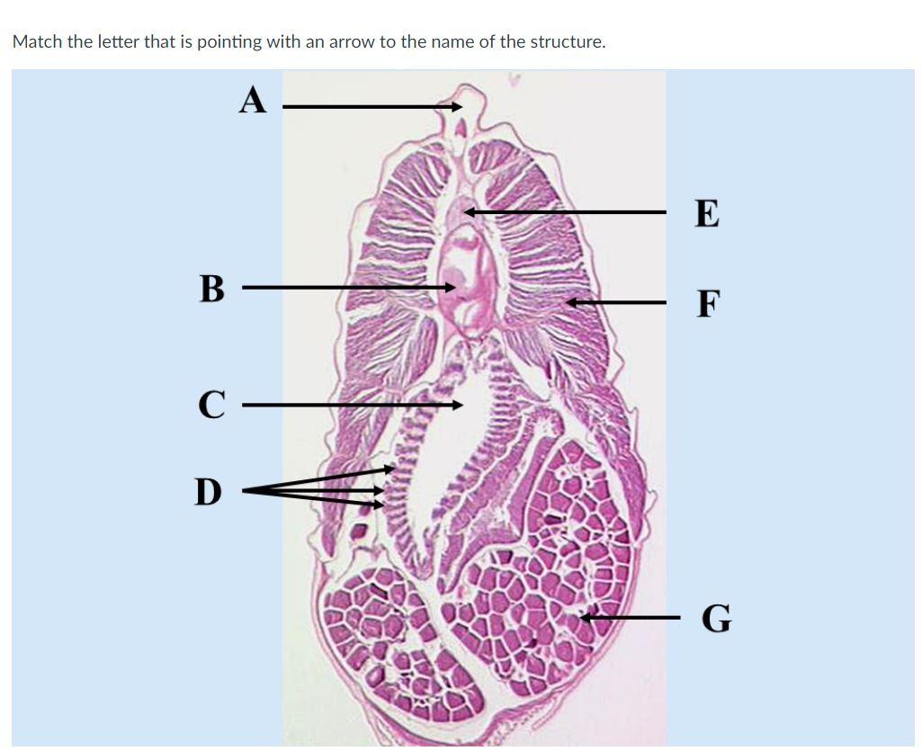Solved Identify the structures that are marked with letters. | Chegg.com