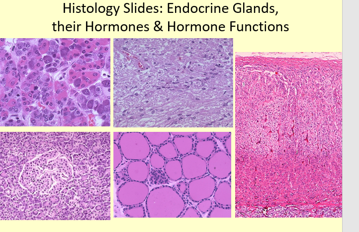 Solved Histology Slides: Endocrine Glands, their Hormones \& | Chegg.com