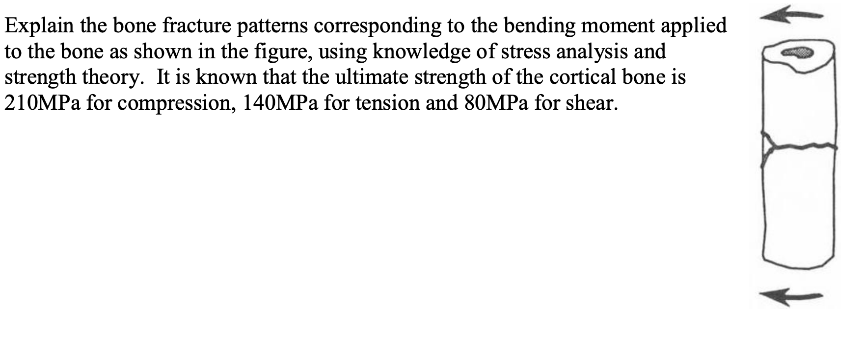 Solved Explain the bone fracture patterns corresponding to | Chegg.com