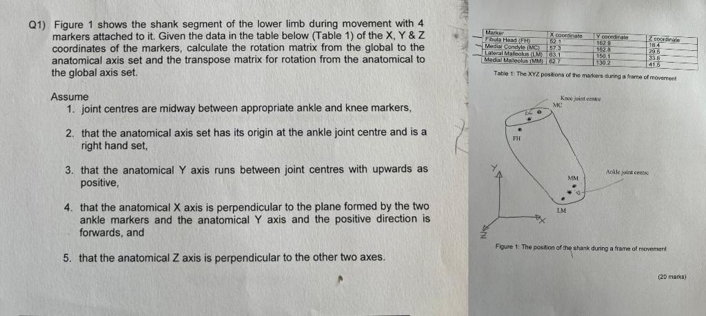 Q1) Figure 1 shows the shank segment of the lower | Chegg.com