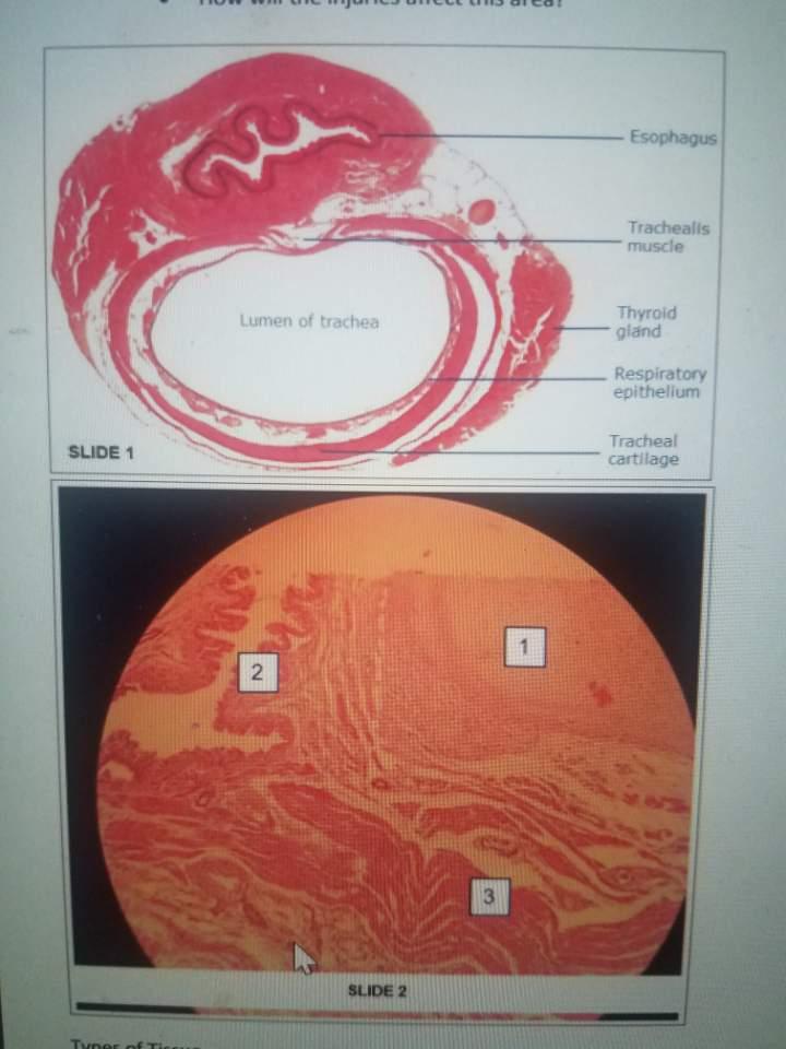 solved-identify-and-describe-the-three-labeled-tissue-typ-chegg