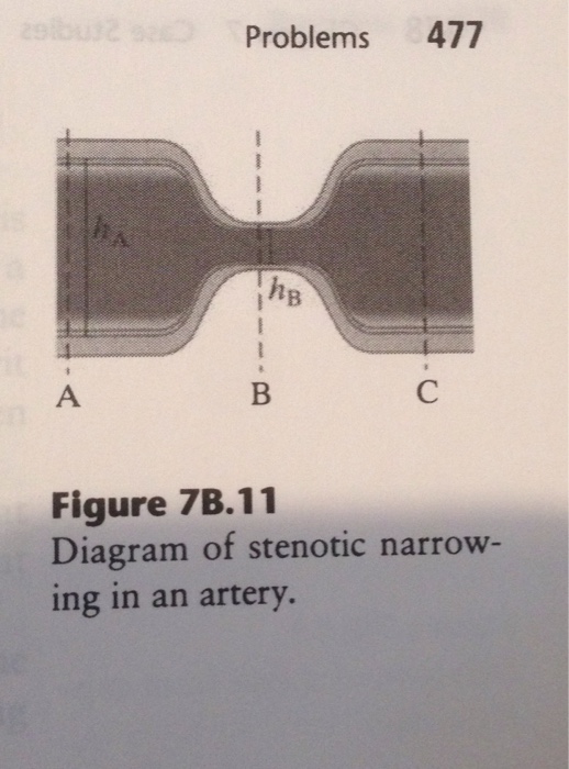 Solved 11 M, P) The narrowing of blood vessels is stenosis | Chegg.com
