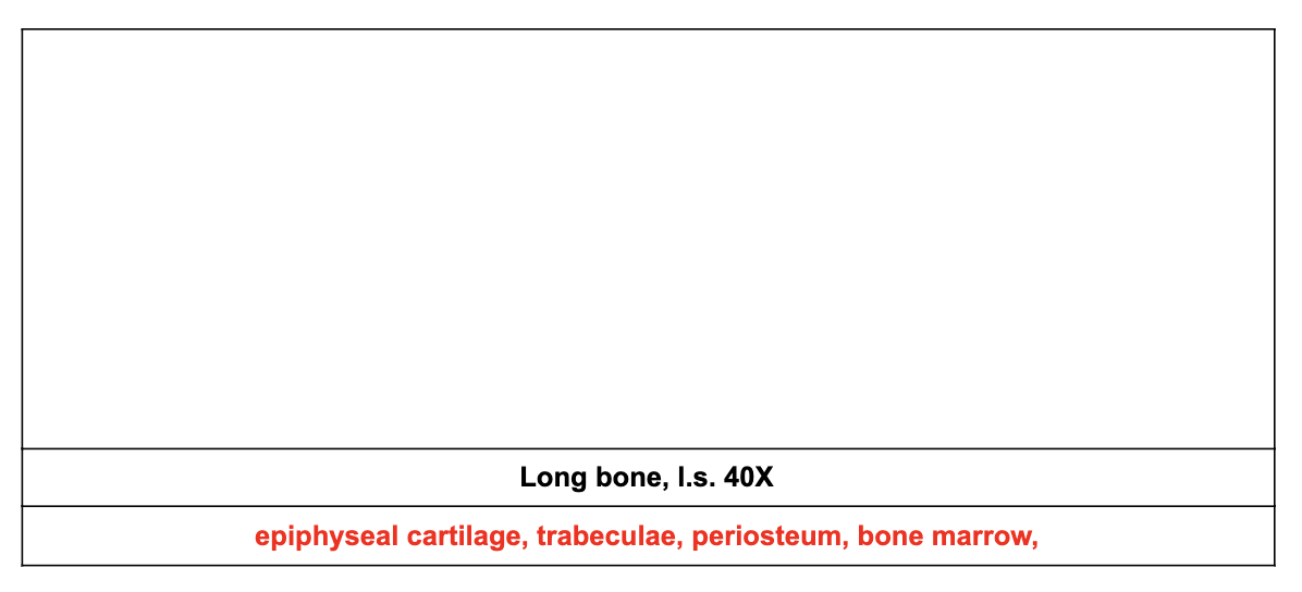 Solved Long bone, I.s. 40X epiphyseal cartilage, trabeculae, | Chegg.com