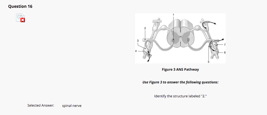 Solved Question 16 Figure 3 ANS Pathway Use Figure 3 to | Chegg.com Solved Question 16 Figure 3 ANS Pathway Use Figure 3 to | Chegg.com