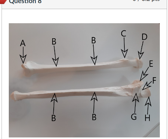 Solved The structure indicated by "A" issuperior angleThe | Chegg.com