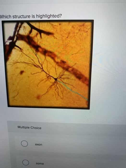 Solved Which structure is highlighted? Multiple Choice axon | Chegg.com