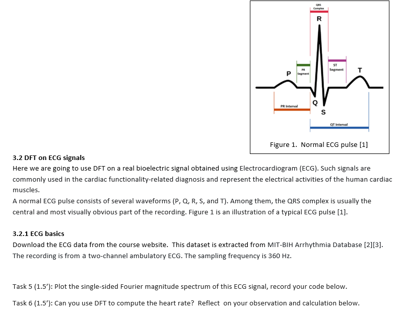 3.2 DFT on ECG signals Here we are going to use DFT | Chegg.com