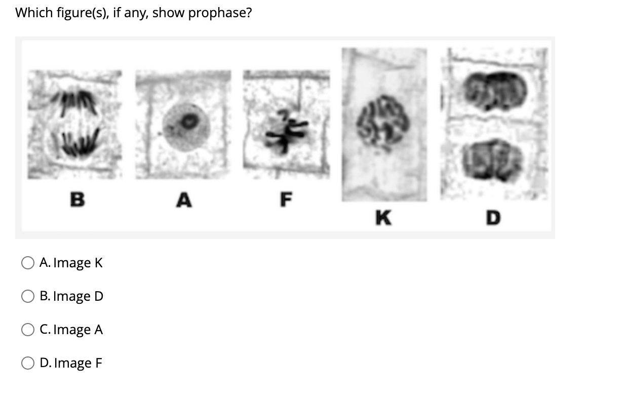 Solved Which figure(s), if any, show prophase? A. Image K B. | Chegg.com
