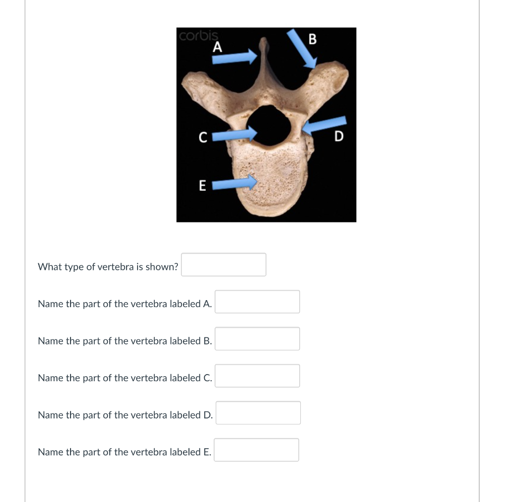 Solved What type of vertebra is shown? Name the part of the | Chegg.com