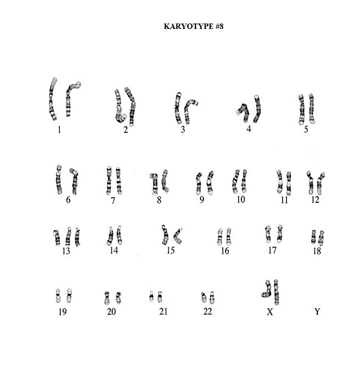 Solved KARYOTYPE #1 2 4 Bene 230 6 7 10 11 12 EKST 13 14 15 | Chegg.com