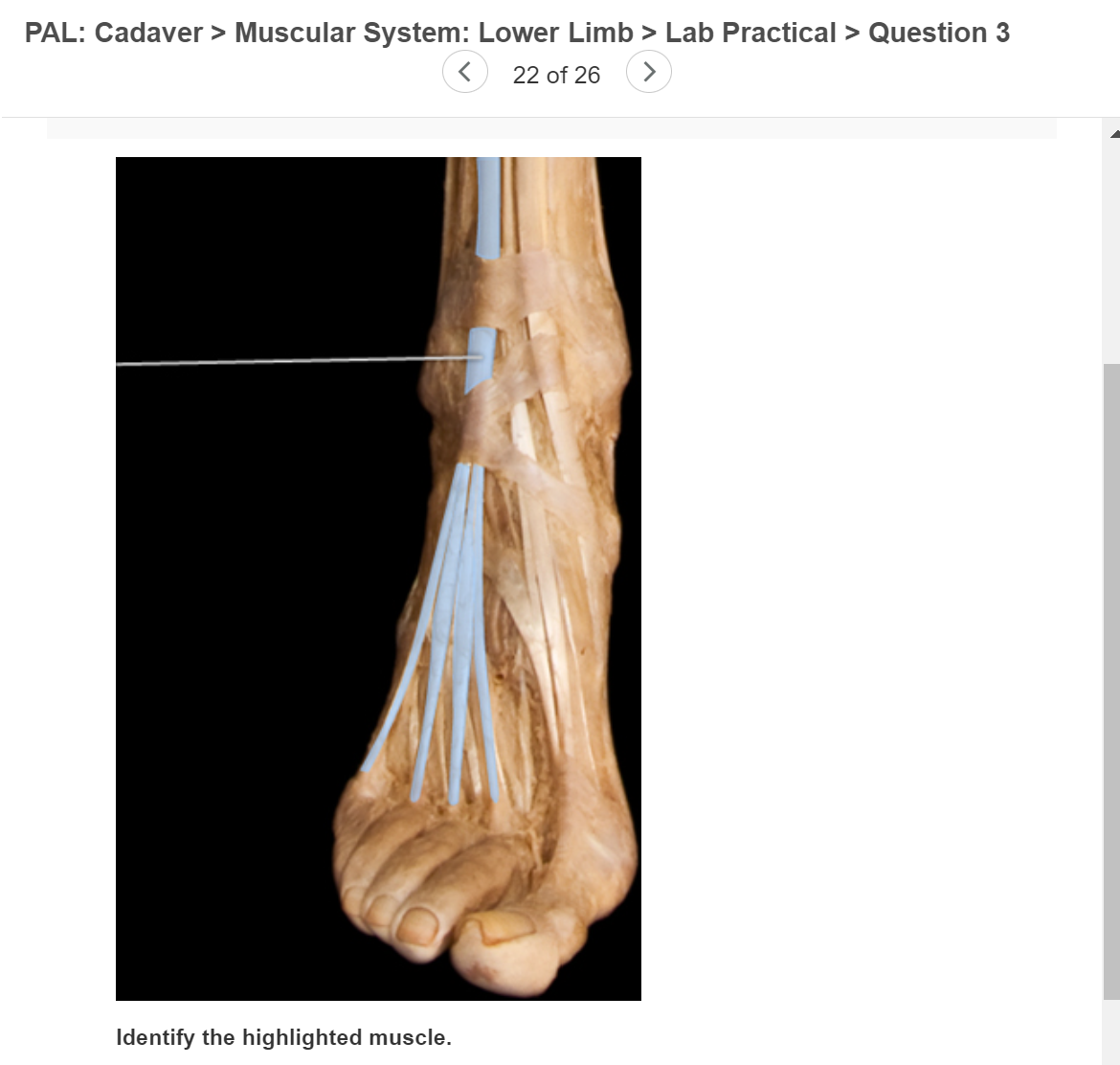 Solved PAL: Cadaver > Muscular System: Head and Neck > Lab | Chegg.com