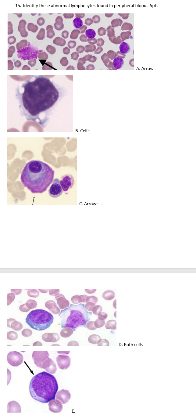 Solved 15. Identify these abnormal lymphocytes found in | Chegg.com