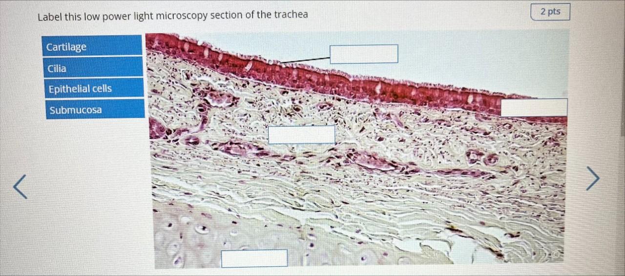 Solved Label this low power light microscopy section of the | Chegg.com