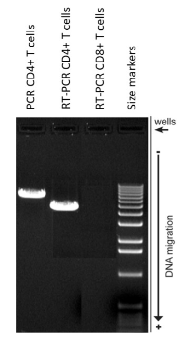 Solved 16. Describe the difference in the bands for the PCR | Chegg.com