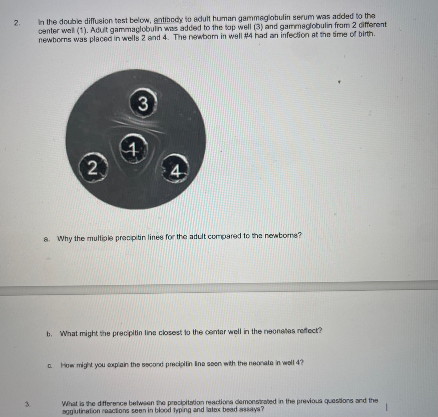 Solved In the double diffusion test below, antibody to adult | Chegg.com