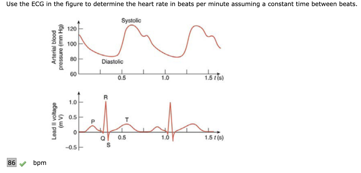 Solved Use the ECG in the figure to determine the heart rate | Chegg.com