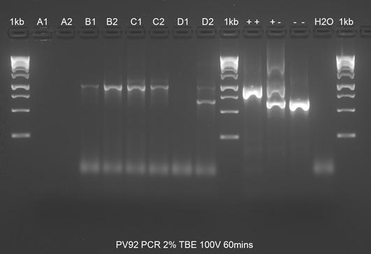 Reading gel electrophoresis results I don't really | Chegg.com