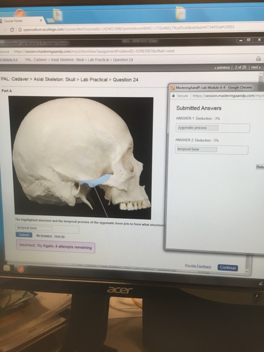 Anatomy And Physiology Archive | October 11, 2017 | Chegg.com