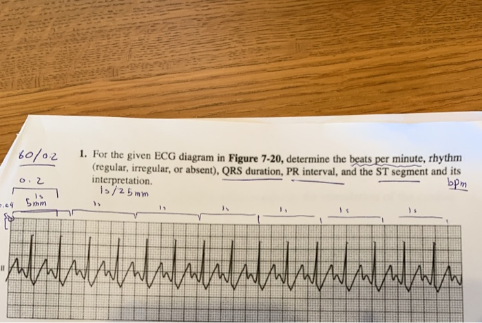 6o/02 1. For the given ECG diagram in Figure 7-20, | Chegg.com