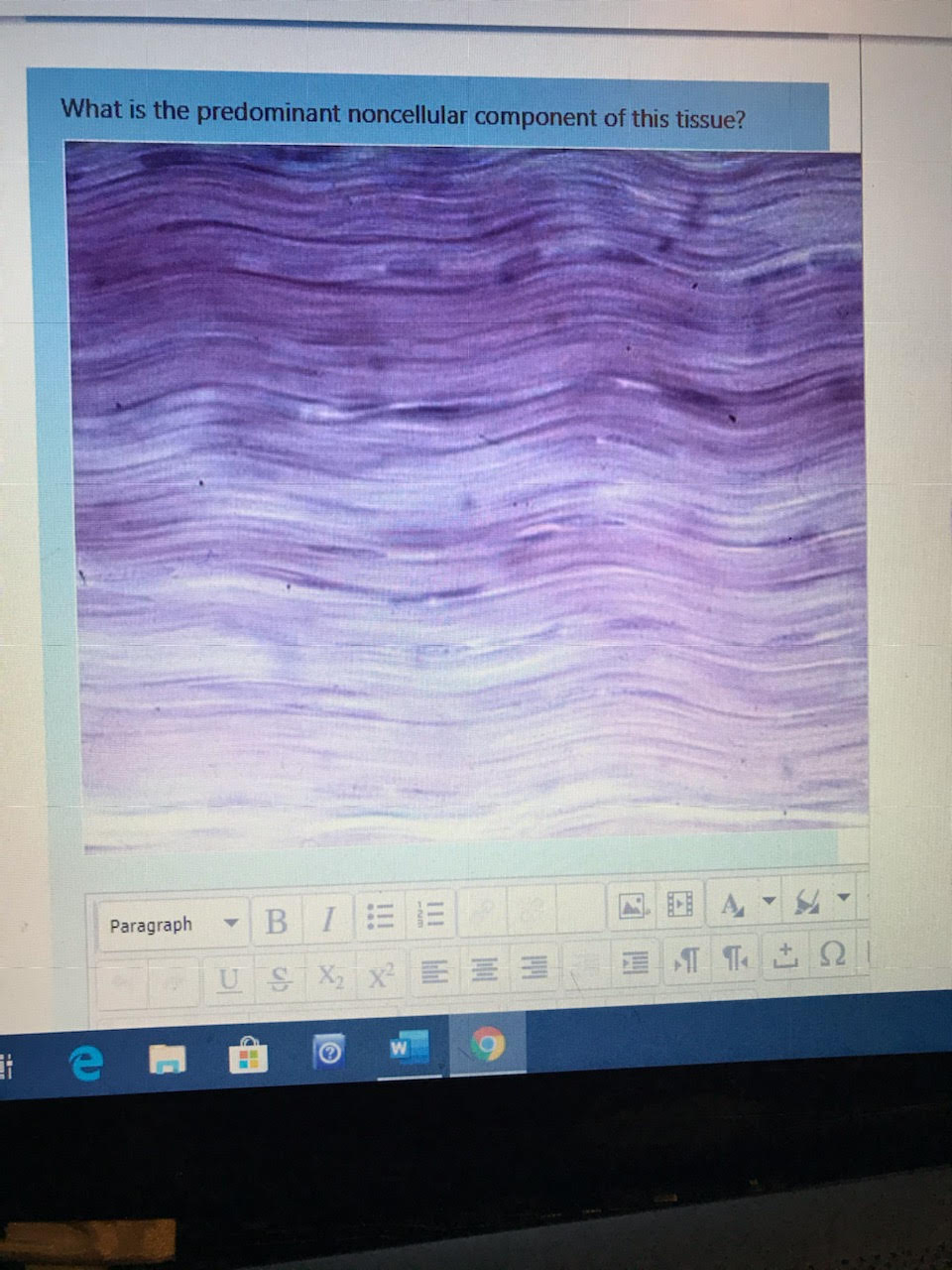 Solved Path: p What is the predominant cell type in this | Chegg.com
