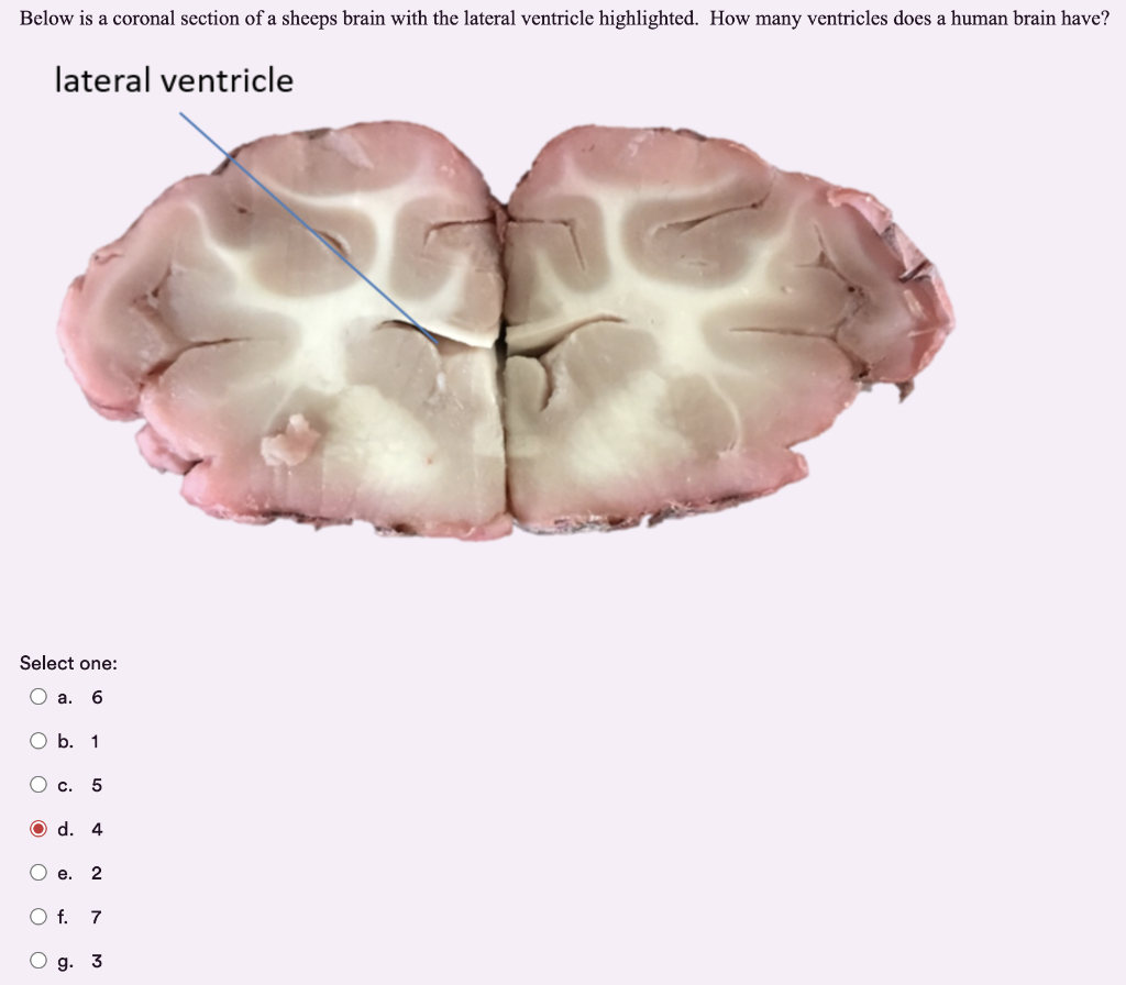 Ventricles Of The Sheep Brain PPT The Human Brain PowerPoint