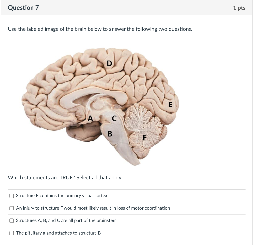 Solved The image below depicts a stretch receptor. This | Chegg.com