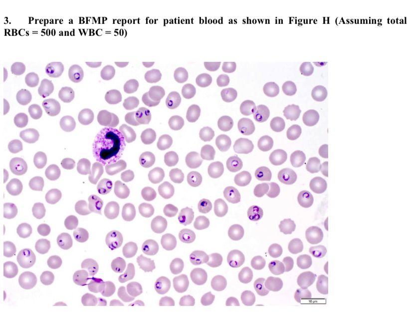 3. Prepare a BFMP report for patient blood as shown | Chegg.com