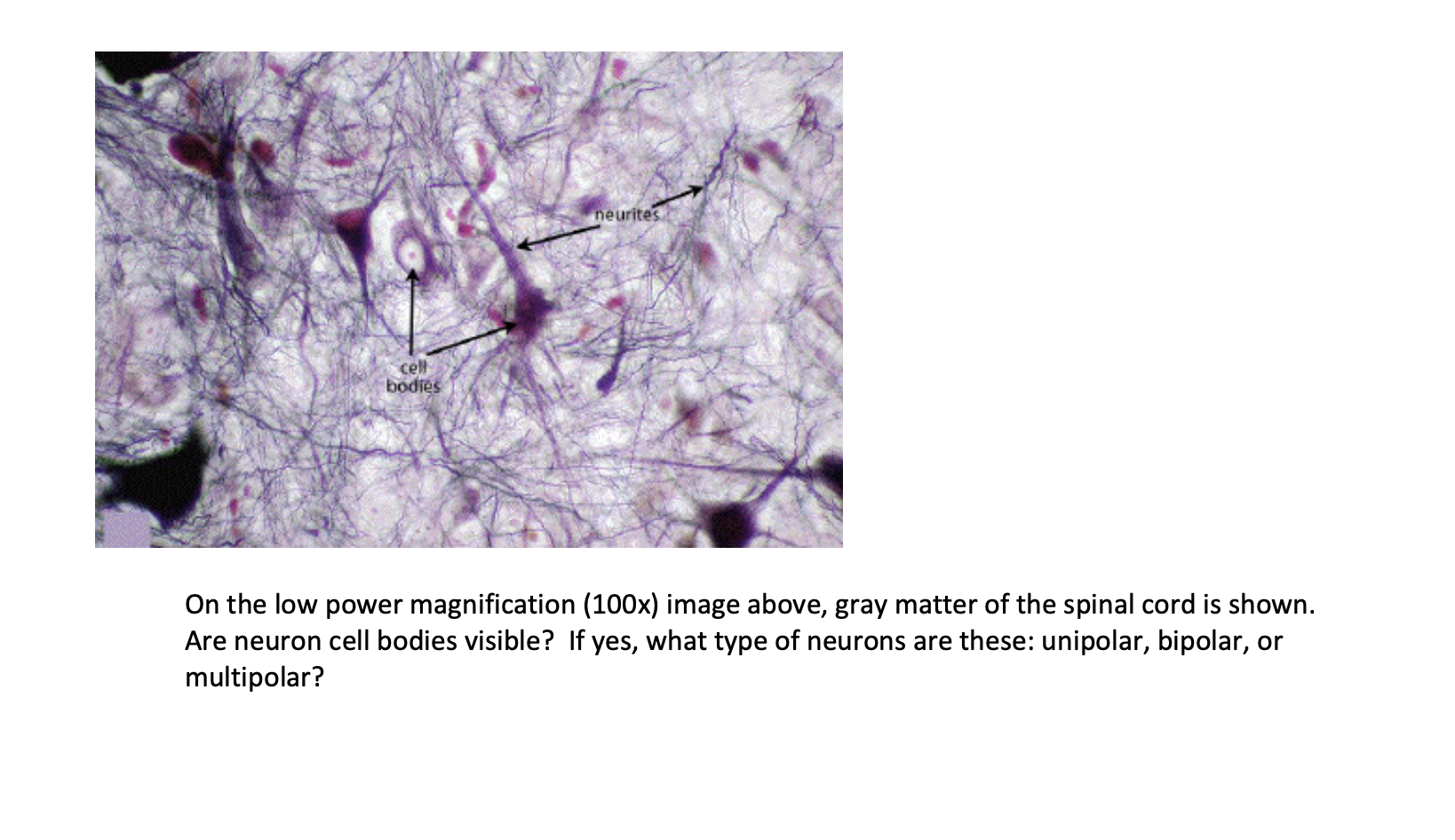 Solved neurites cel bodies On the low power magnification | Chegg.com
