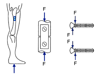 Solved In a healthy person, when supporting their entire | Chegg.com